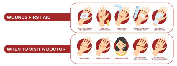 Understanding Industrial Accidents: What They Are, How They're Classified
